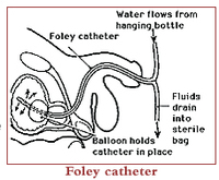 Enlarged Prostate Santa Barbara Urologists - Santa Barbara Urologist ...