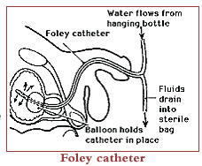 Enlarged Prostate Santa Barbara Urologists - Santa Barbara Urologist ...