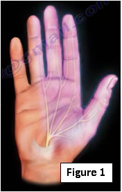 Common Hand and Finger Problems - Thrive Global