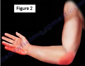 Common Hand and Finger Problems - Thrive Global