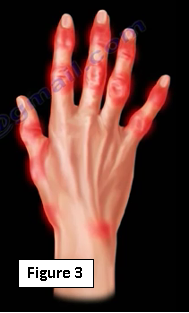 Common Hand and Finger Problems - Thrive Global