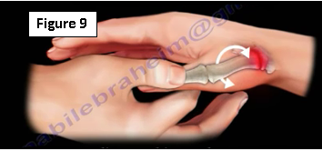 Common Hand and Finger Problems - Thrive Global