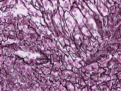 Reticular Tissue Labeled