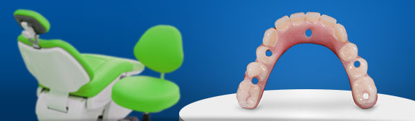 Chairside Conversion