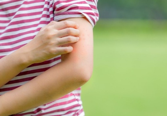 Conozca los insectos que transmiten enfermedades