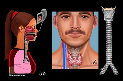 Head and Neck Anatom... | Scope Airway Larynx Anatomy Poster P… | MagCloud