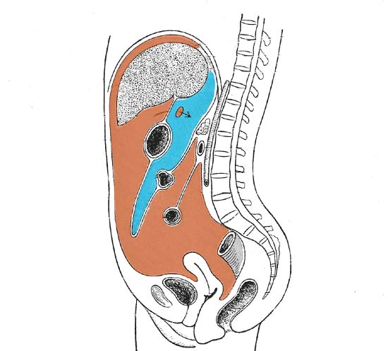 Peritoneal Fluid Anatomy Of Peritoneum
