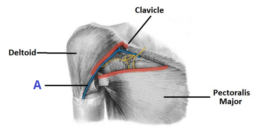 The Axilla Region - Borders - Contents - TeachMeAnatomy