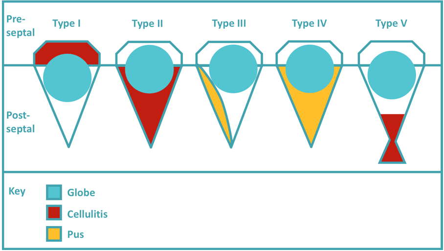 Peri-orbital Cellulitis- Pathophysiology- Managment- TeachMePaediatrics
