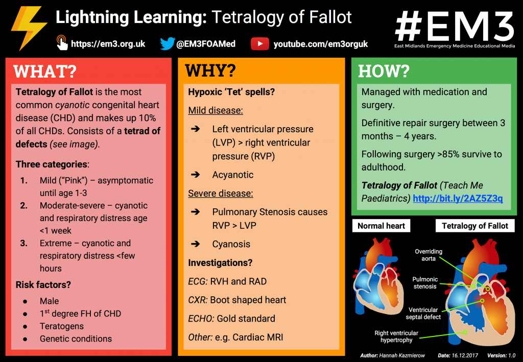 Tetralogy of Fallot- Pathophysiology -Managment- TeachMePaediatrics