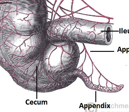 Acute Appendicitis - Clinical Features - Management - TeachMeSurgery