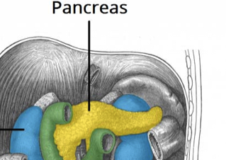 Acute Pancreatitis - Causes - Investigations - Management - TeachMeSurgery