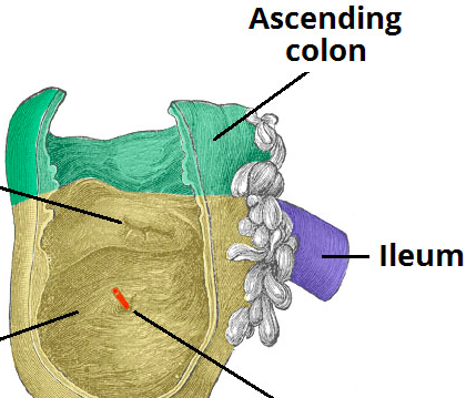 Examination of a Stoma - Colostomy - Ileostomy - OSCE - TeachMeSurgery