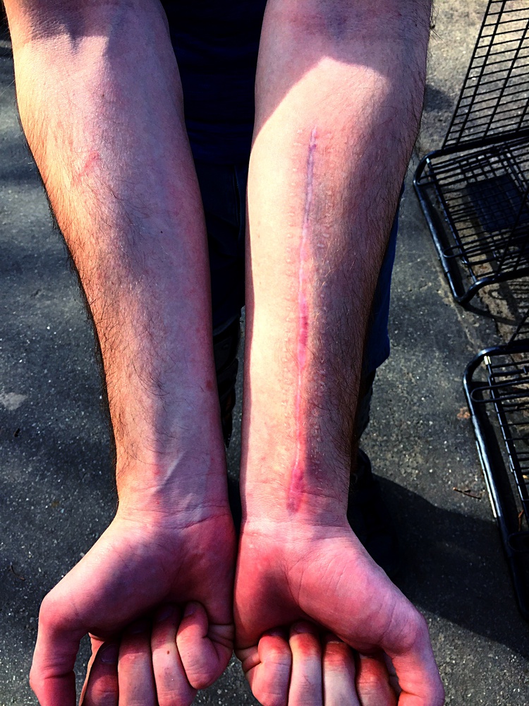 jacquesarms | Magazine | The Harvard Crimson