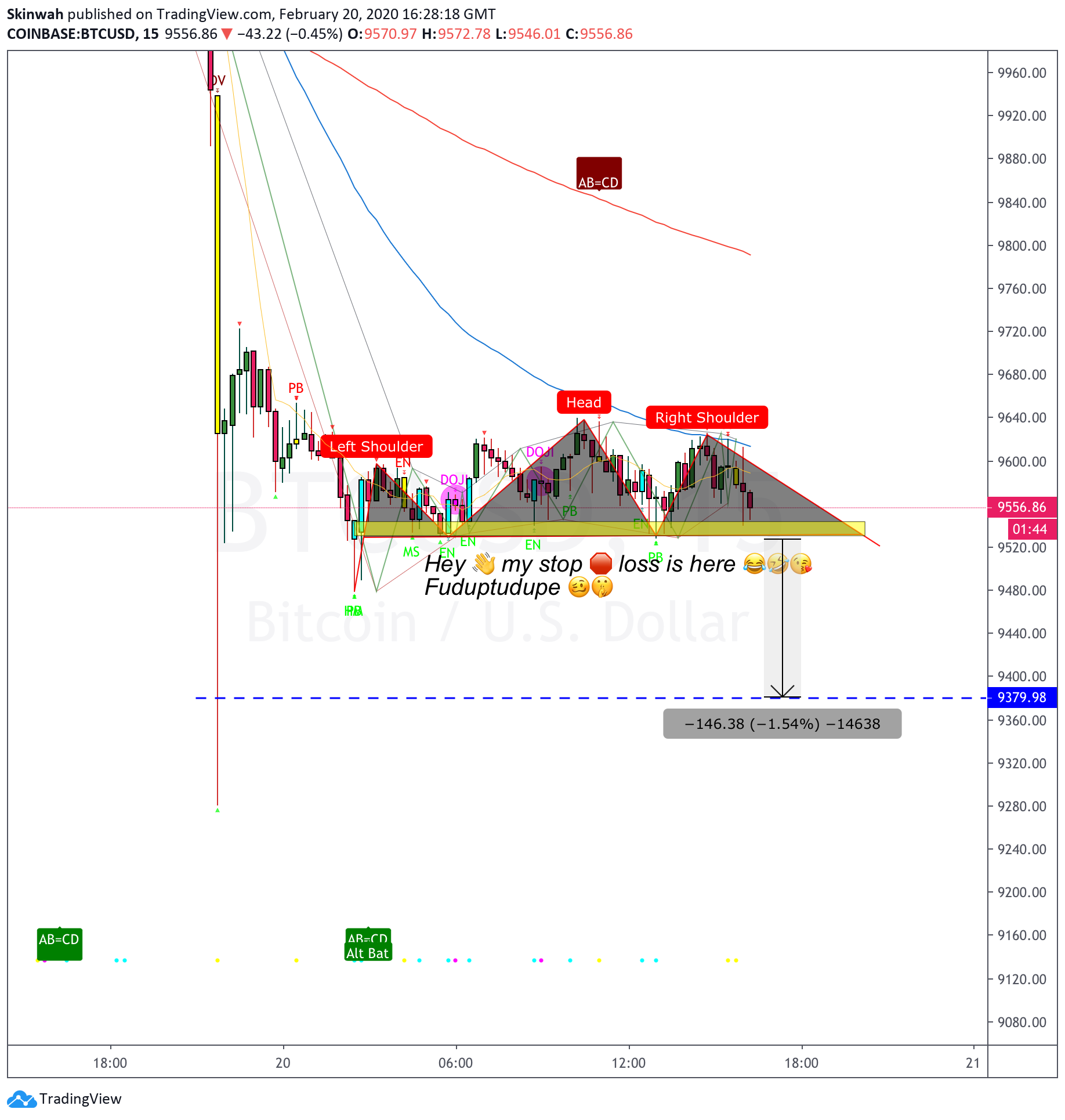 Where is your stop loss on BTC? for COINBASE:BTCUSD by Skinwah ...
