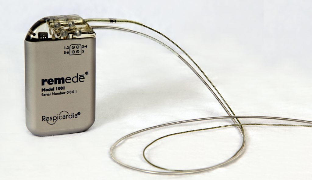 UCHealth first in region to offer latest technology for central sleep ...