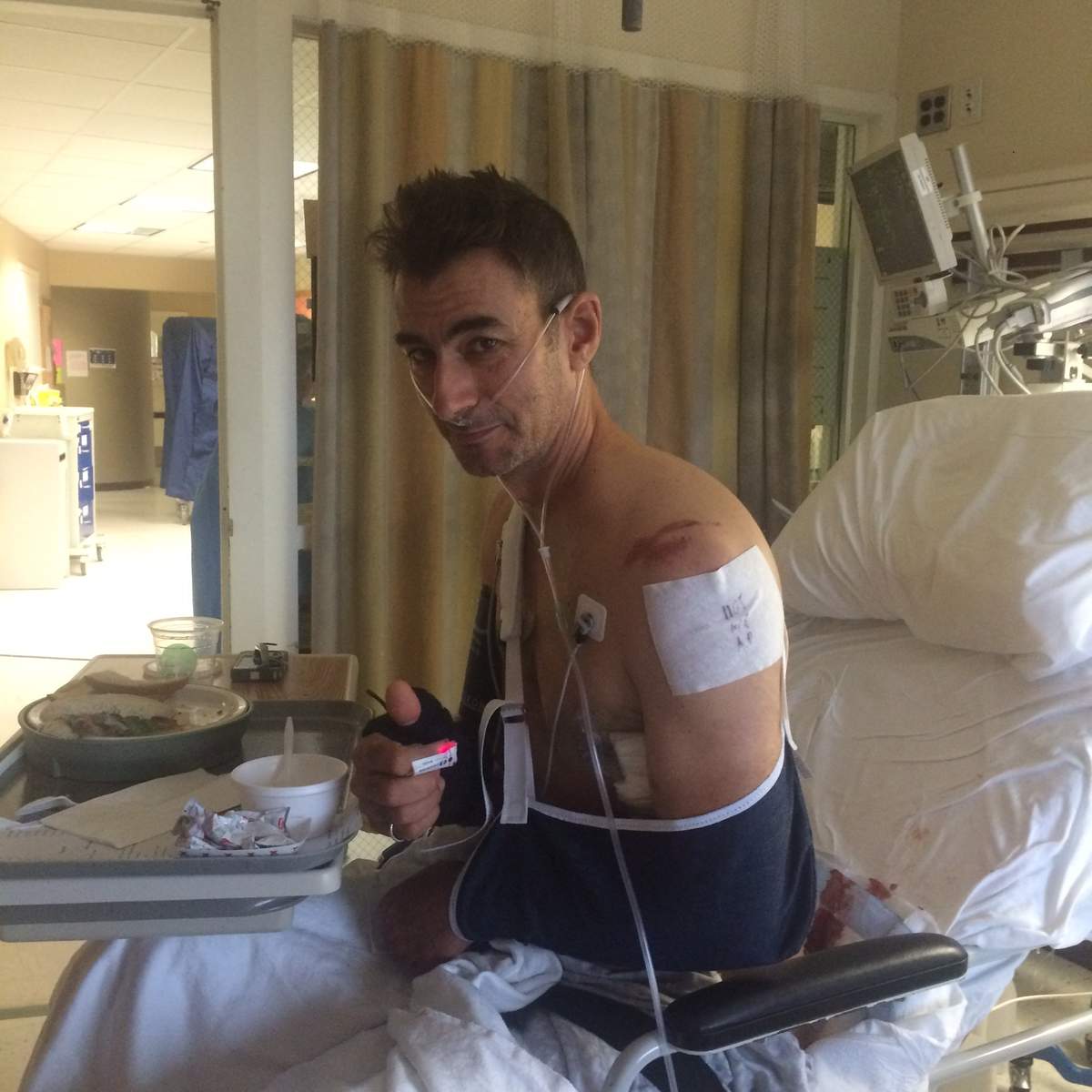 Your worst bmx injury - BMXmuseum.com Forums