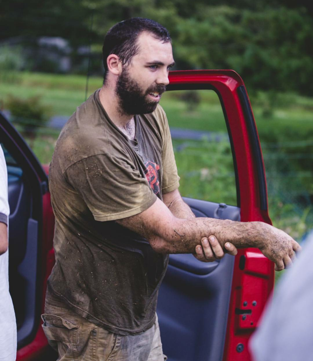 Your worst bmx injury - BMXmuseum.com Forums