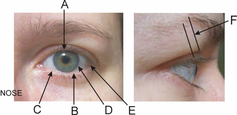 ESP - Portrait & Figure Fundamentals - Lesson 1 - WetCanvas: Online ...