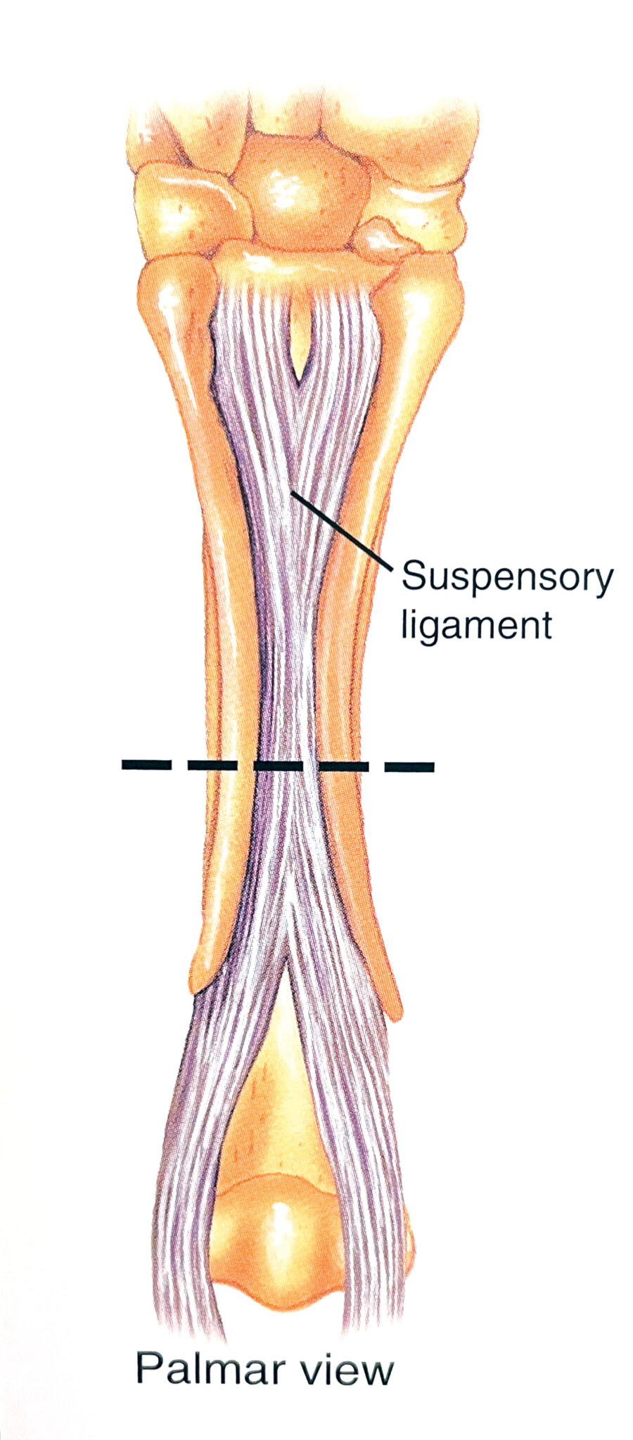 Understanding Degenerative Suspensory Ligament Desmitis (DSLD ...