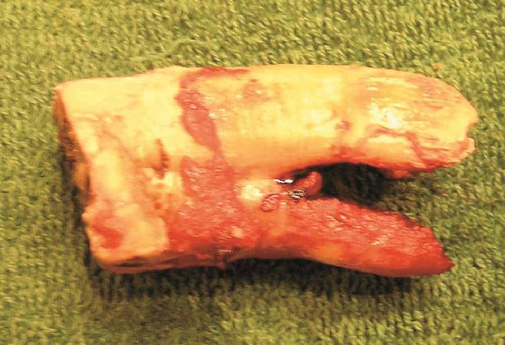 Thinking Through Cheek Tooth Extraction Complications (AAEP 2012) – The ...