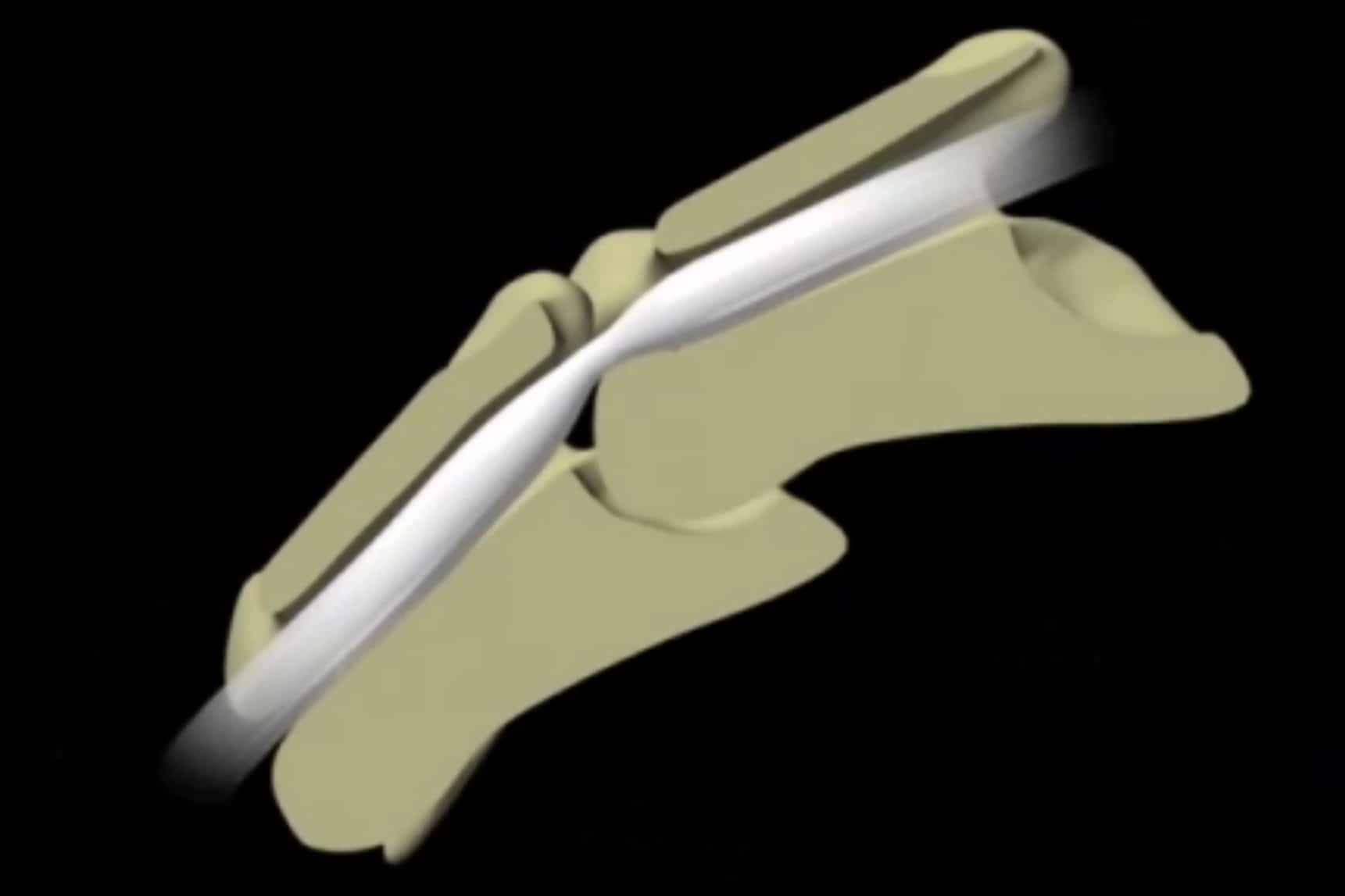 Wobbler Syndrome: What Do We Know and Where Do We Go From Here? – The Horse