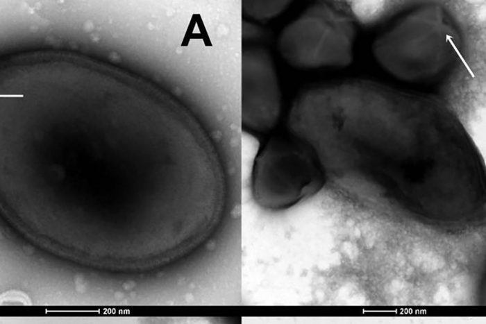 Ancient 'Zombie' Viruses Revived From Siberian Permafrost » Explorersweb