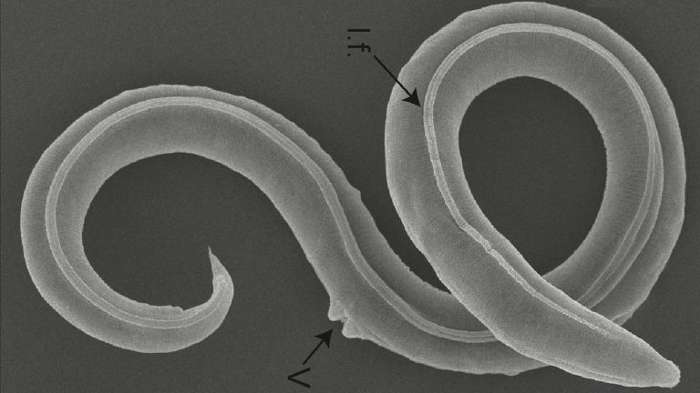 Ancient Worms Revived After 46,000 Years in Siberian Permafrost ...