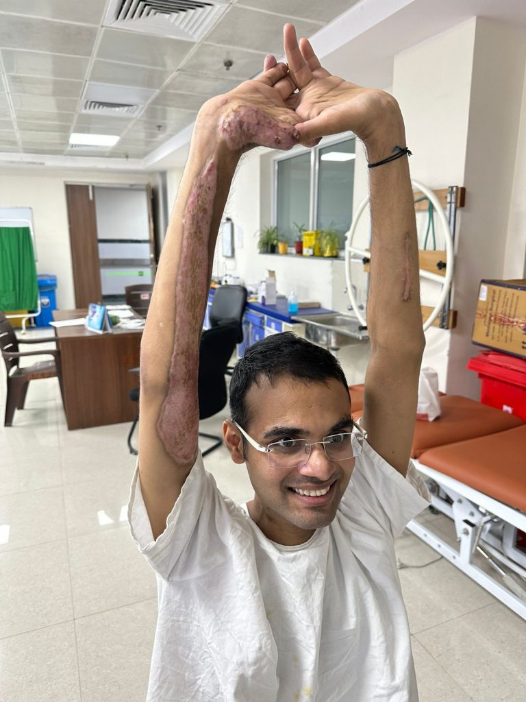 Miracle Man Anurag Maloo Goes Home at Last » Explorersweb