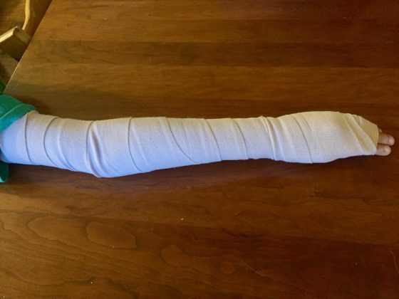 Trail First Aid: Snakebites in North America – iRunFar