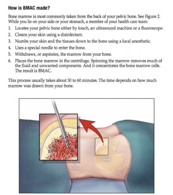 Regenerative Medicine for the Injured Runner – iRunFar