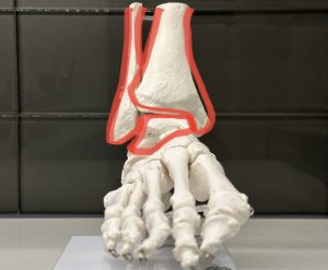 Using the Belt Ankle Stretch to Heal Ankle Injuries and Increase Ankle ...