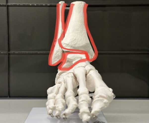 Using the Belt Ankle Stretch to Heal Ankle Injuries and Increase Ankle ...