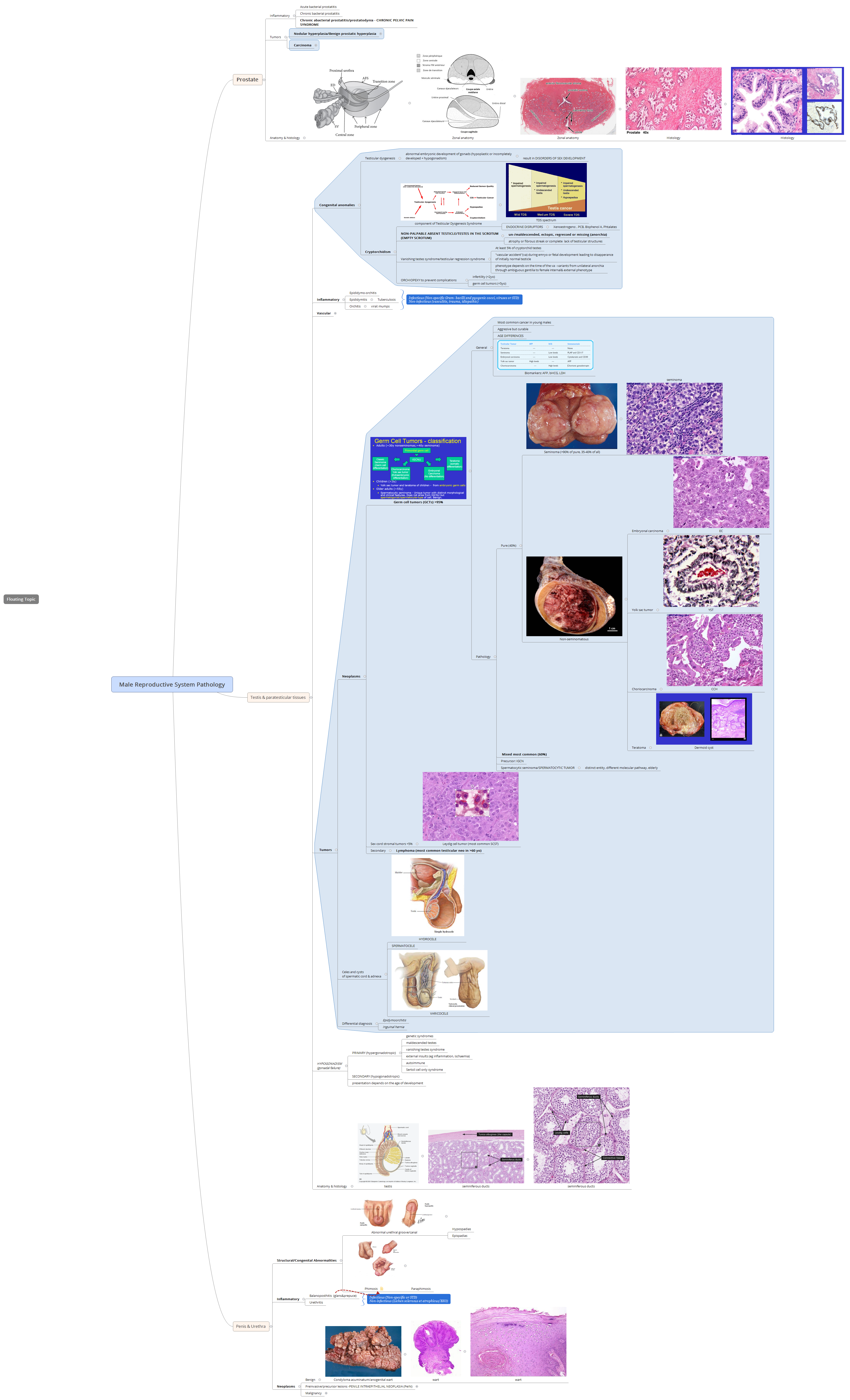 Male Reproductive System Pathology - XMind - Mind Mapping Software