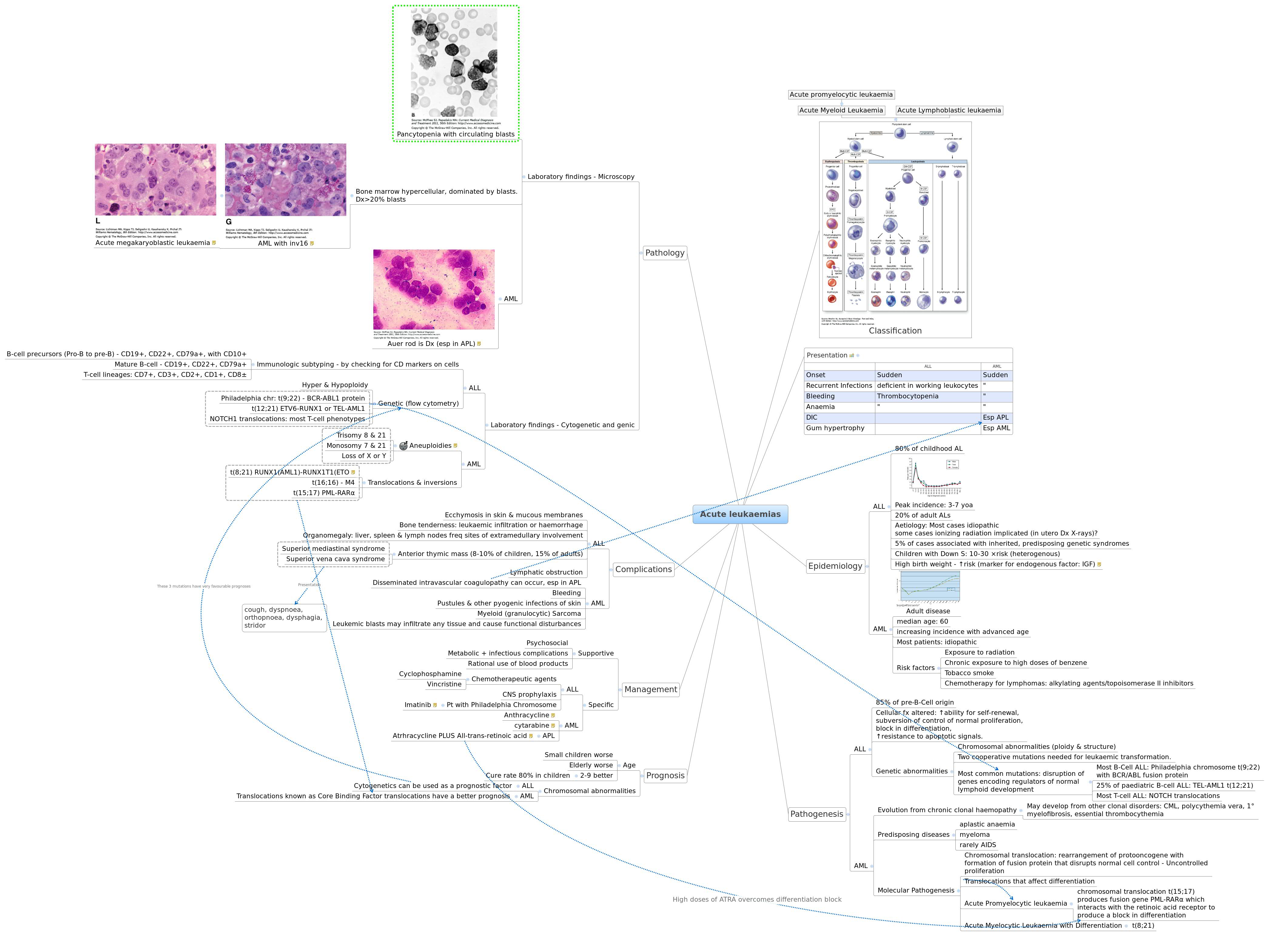 Acute leukaemias - XMind - Mind Mapping Software