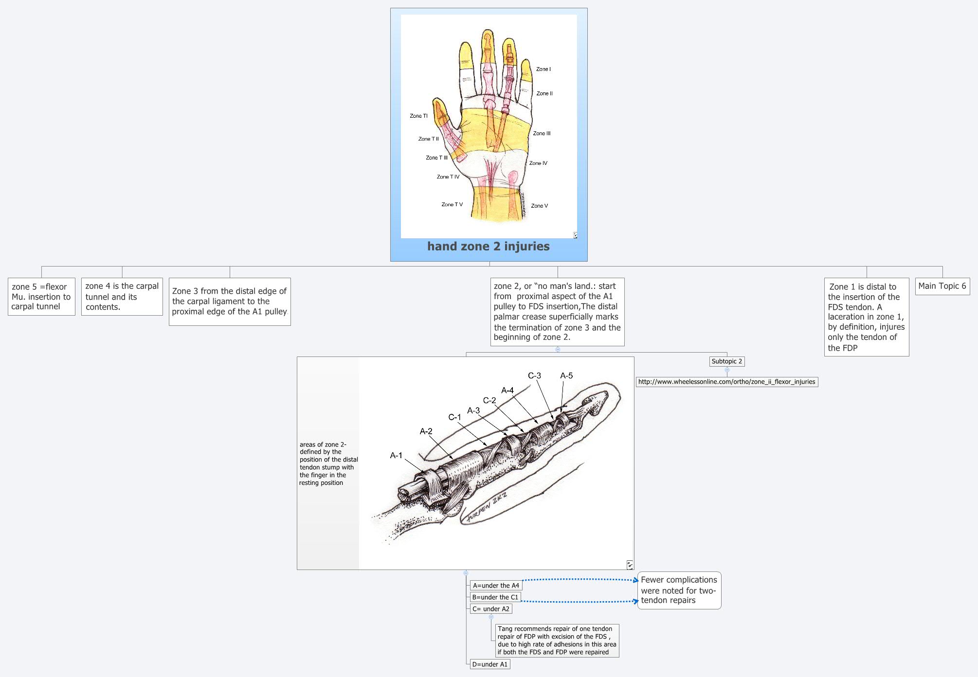 hand zone 2 injuries | Amer Almohssen - Xmind