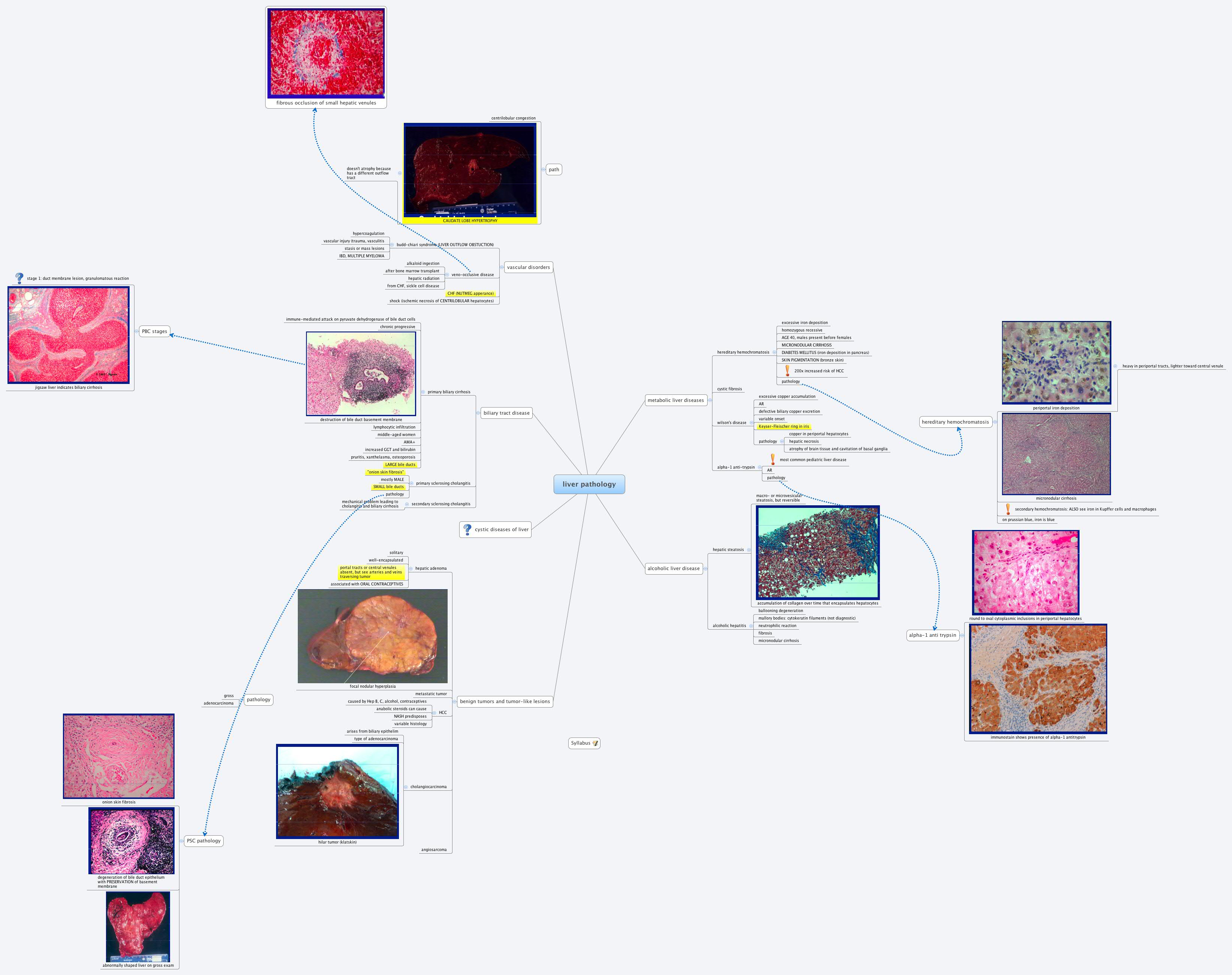 liver pathology - XMind - Mind Mapping Software