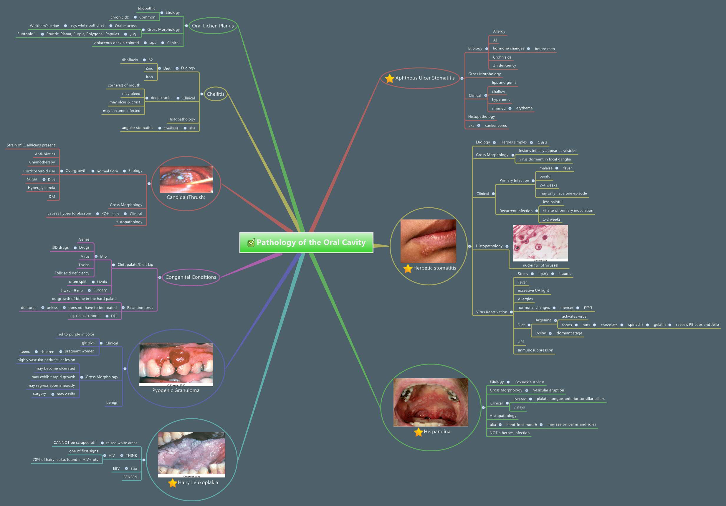 Pathology of the Oral Cavity - XMind - Mind Mapping Software