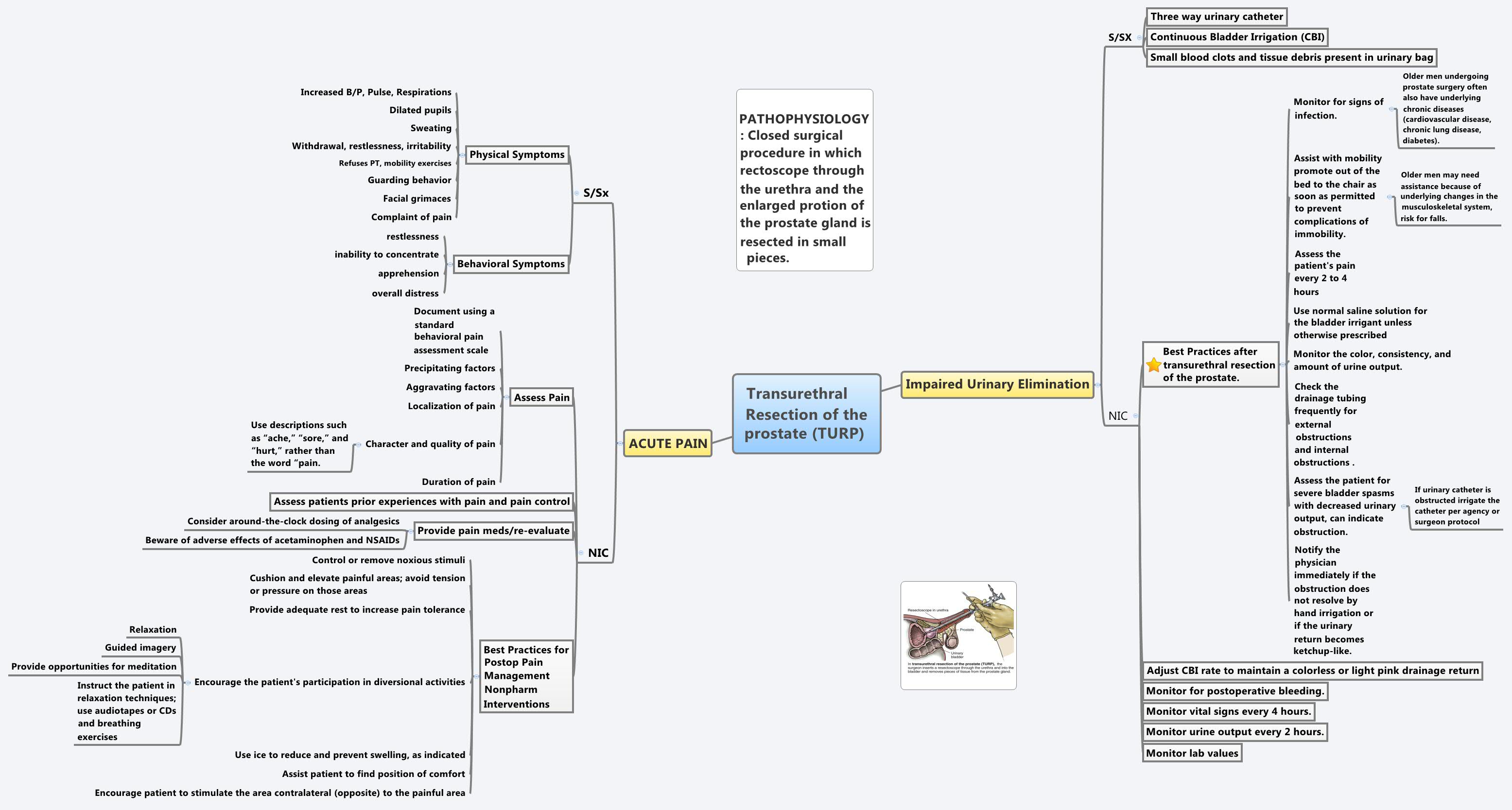 Transurethral Resection of the prostate (TURP) | OlveraRo12 - Xmind
