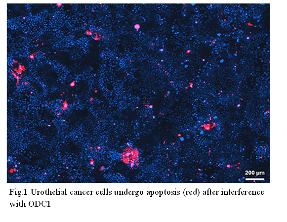 Basic Hallmarks of Urothelial Cancer Unleashed in Primary Uroepithelium ...