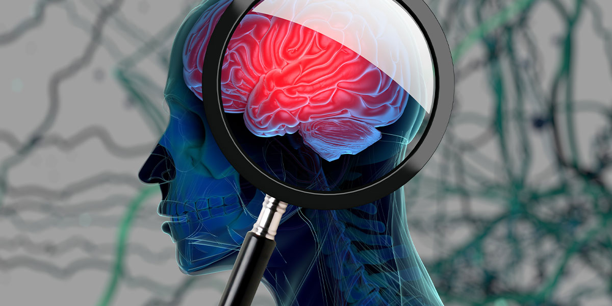 Alzheimer’s Might Not Be Primarily a Brain Disease — A New Theory ...